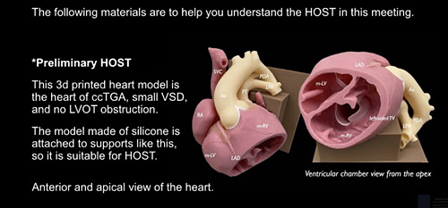 APCIS News - APCIS2022 C5-2 anatomic repair of cc-TGA VSD LVOT using 3d ...